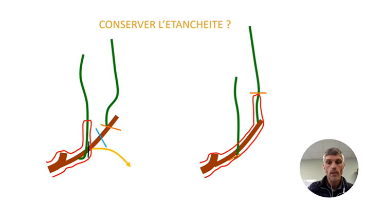 Face-à face entre spécialistes de la taille Poussard et de la taille ...